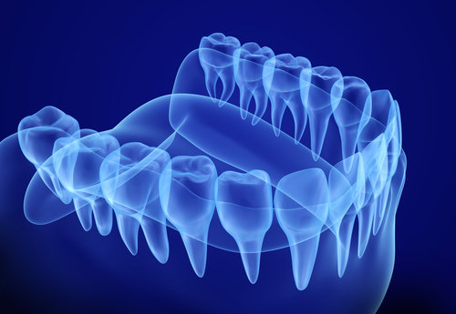 What is Root Absorption?
