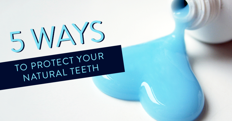 5 Ways To Protect Your Natural Teeth